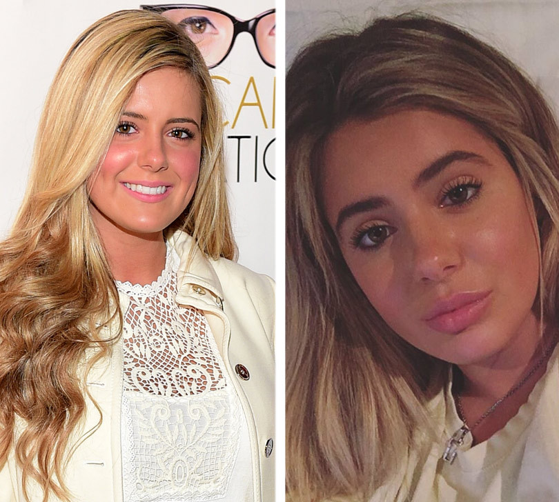 Brielle Biermann Slams Plastic Surgery Rumors Im 19 Now People Look Different